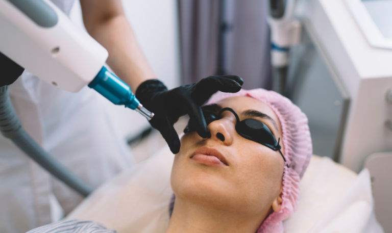 Laser Treatments for Stubborn Pigmentation: Your Skin Solution